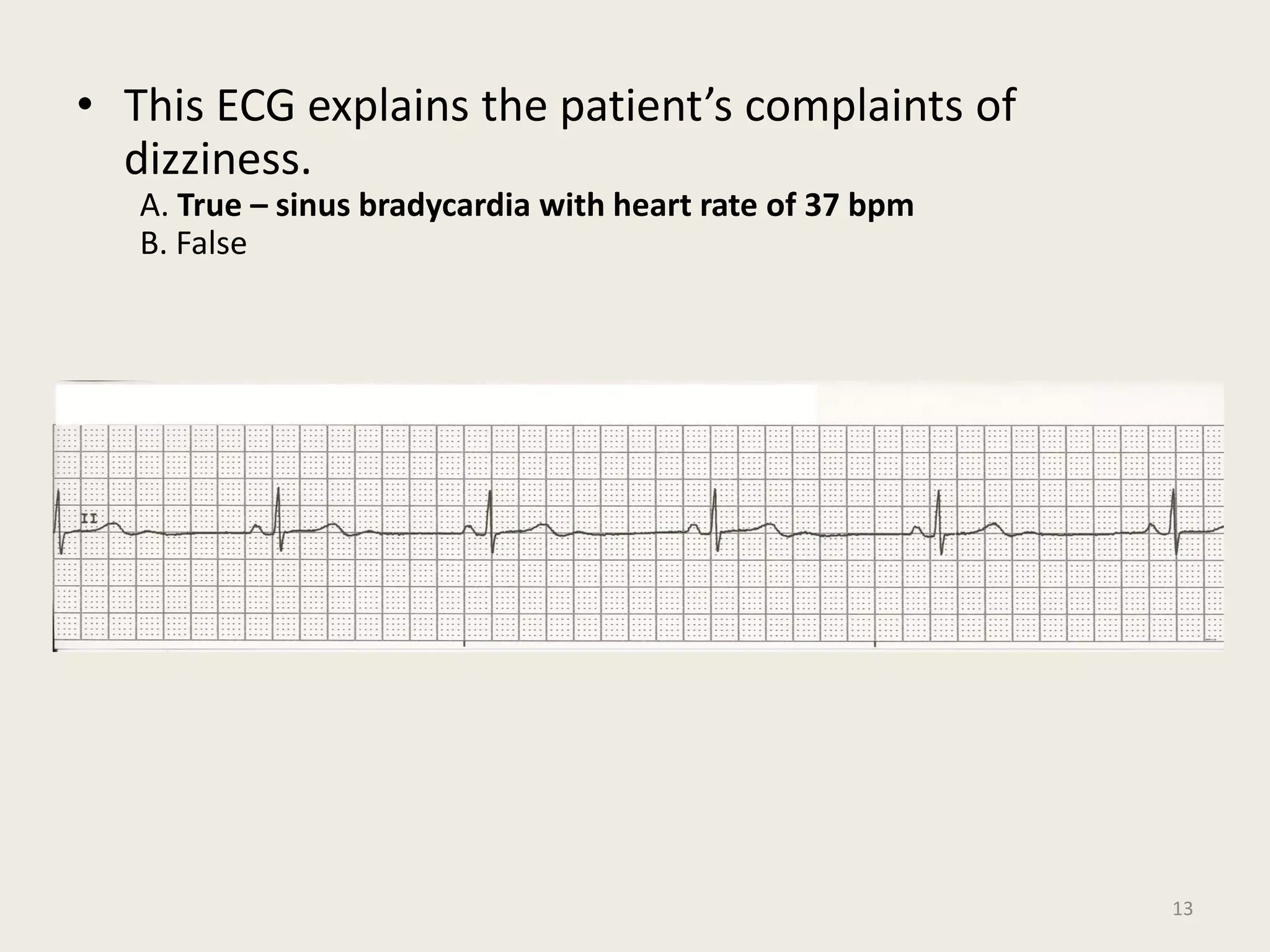 12 Lead EKG Interpretation ( PDFDrive ).pdf