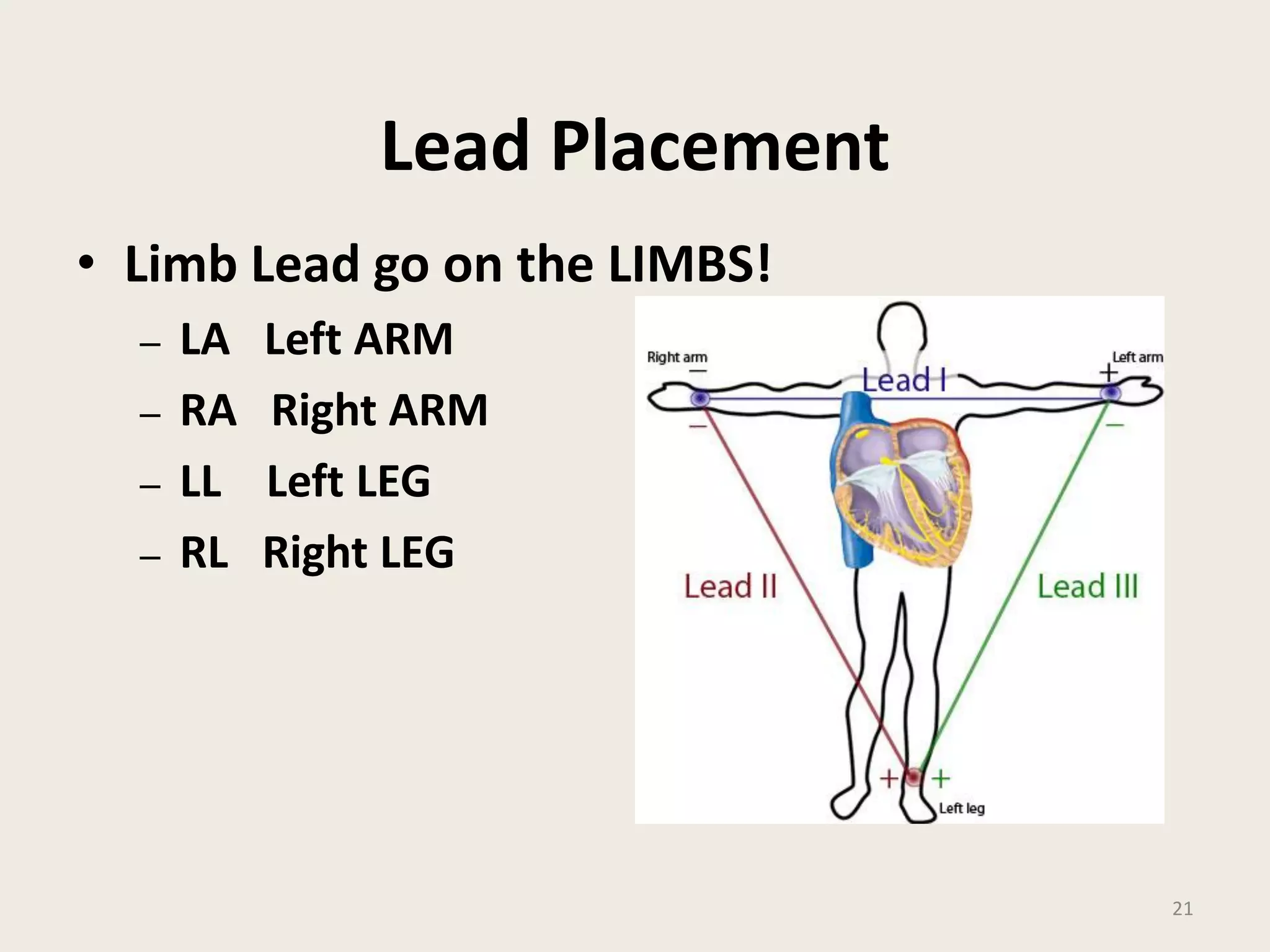 12 Lead EKG Interpretation ( PDFDrive ).pdf