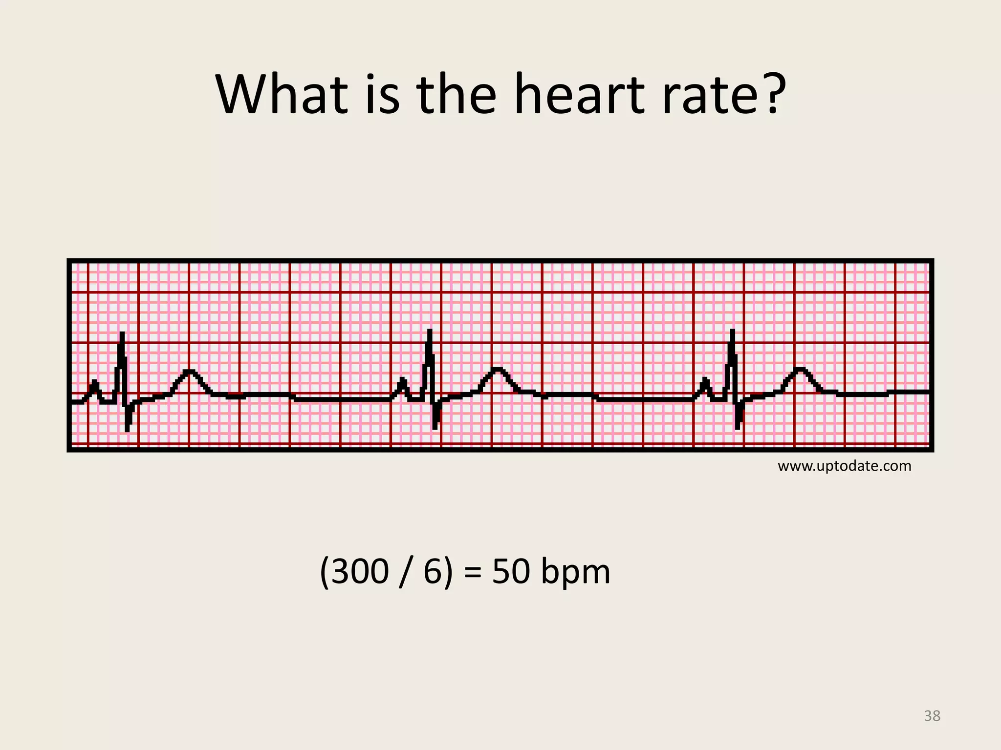 12 Lead EKG Interpretation ( PDFDrive ).pdf