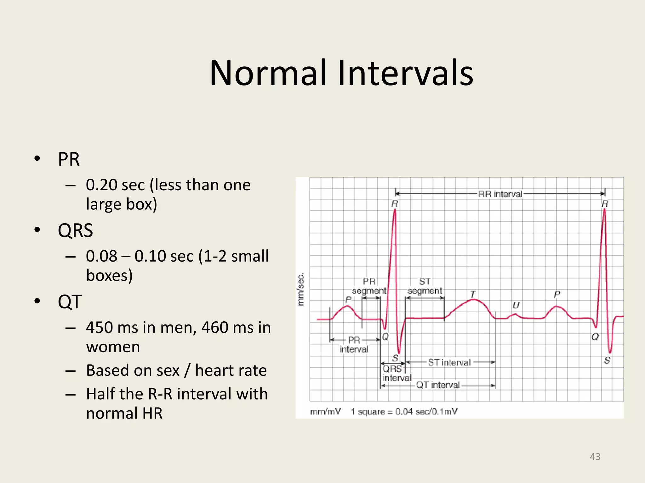 12 Lead EKG Interpretation ( PDFDrive ).pdf