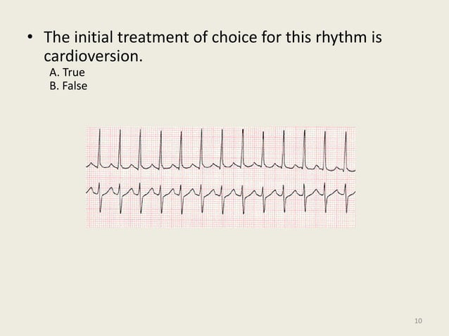 12 Lead EKG Interpretation ( PDFDrive ).pdf