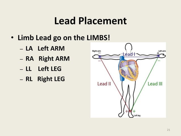 12 Lead EKG Interpretation ( PDFDrive ).pdf