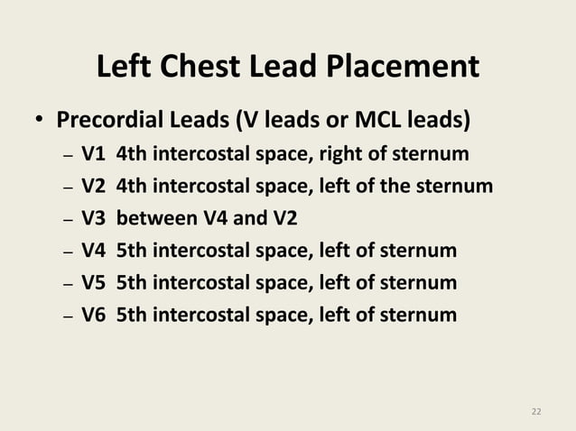 12 Lead EKG Interpretation ( PDFDrive ).pdf