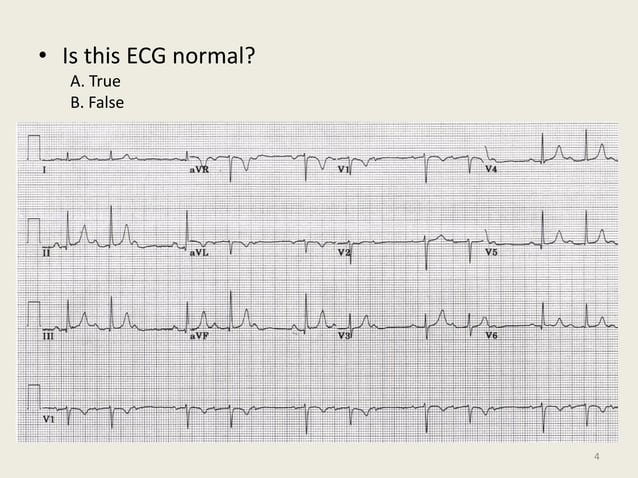 12 Lead EKG Interpretation ( PDFDrive ).pdf