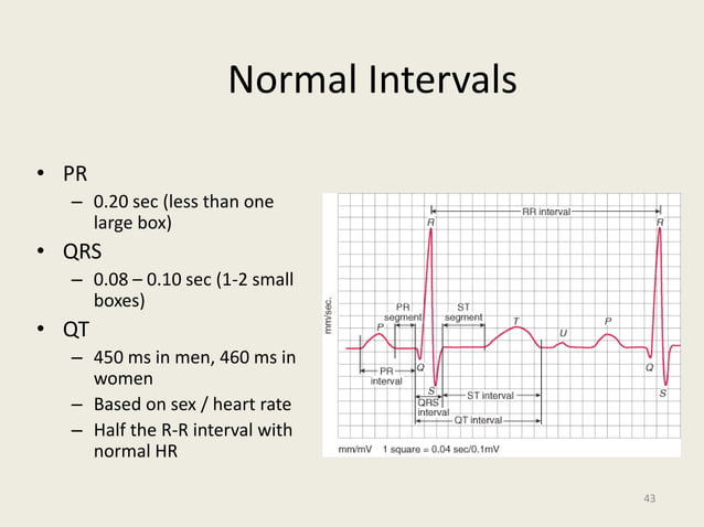 12 Lead EKG Interpretation ( PDFDrive ).pdf