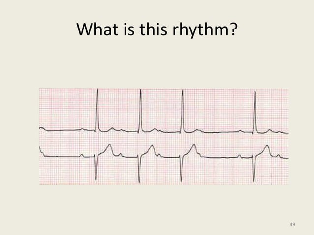 12 Lead EKG Interpretation ( PDFDrive ).pdf