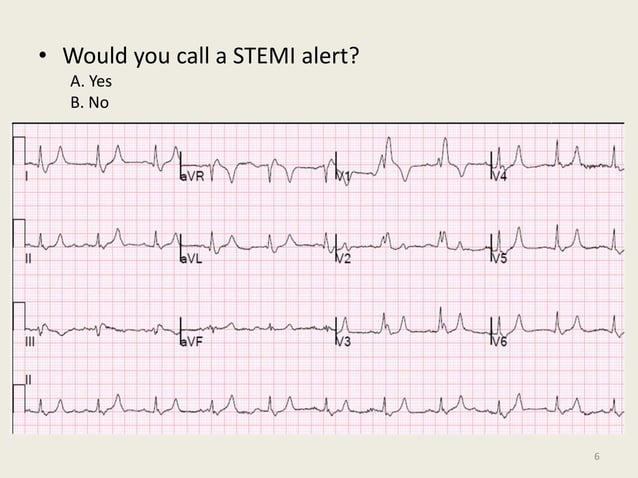 12 Lead EKG Interpretation ( PDFDrive ).pdf