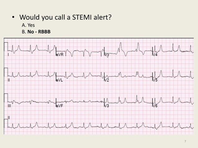12 Lead EKG Interpretation ( PDFDrive ).pdf
