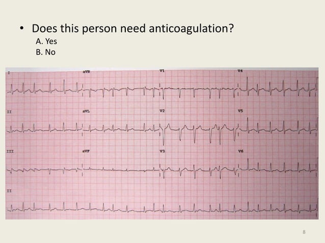 12 Lead EKG Interpretation ( PDFDrive ).pdf