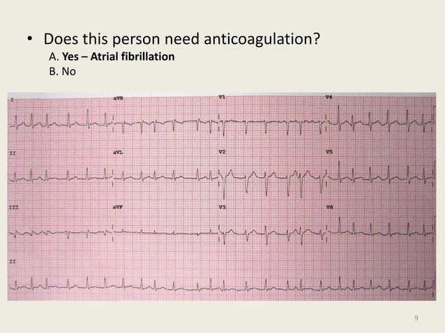 12 Lead EKG Interpretation ( PDFDrive ).pdf