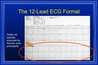 12 leadessential | PPT