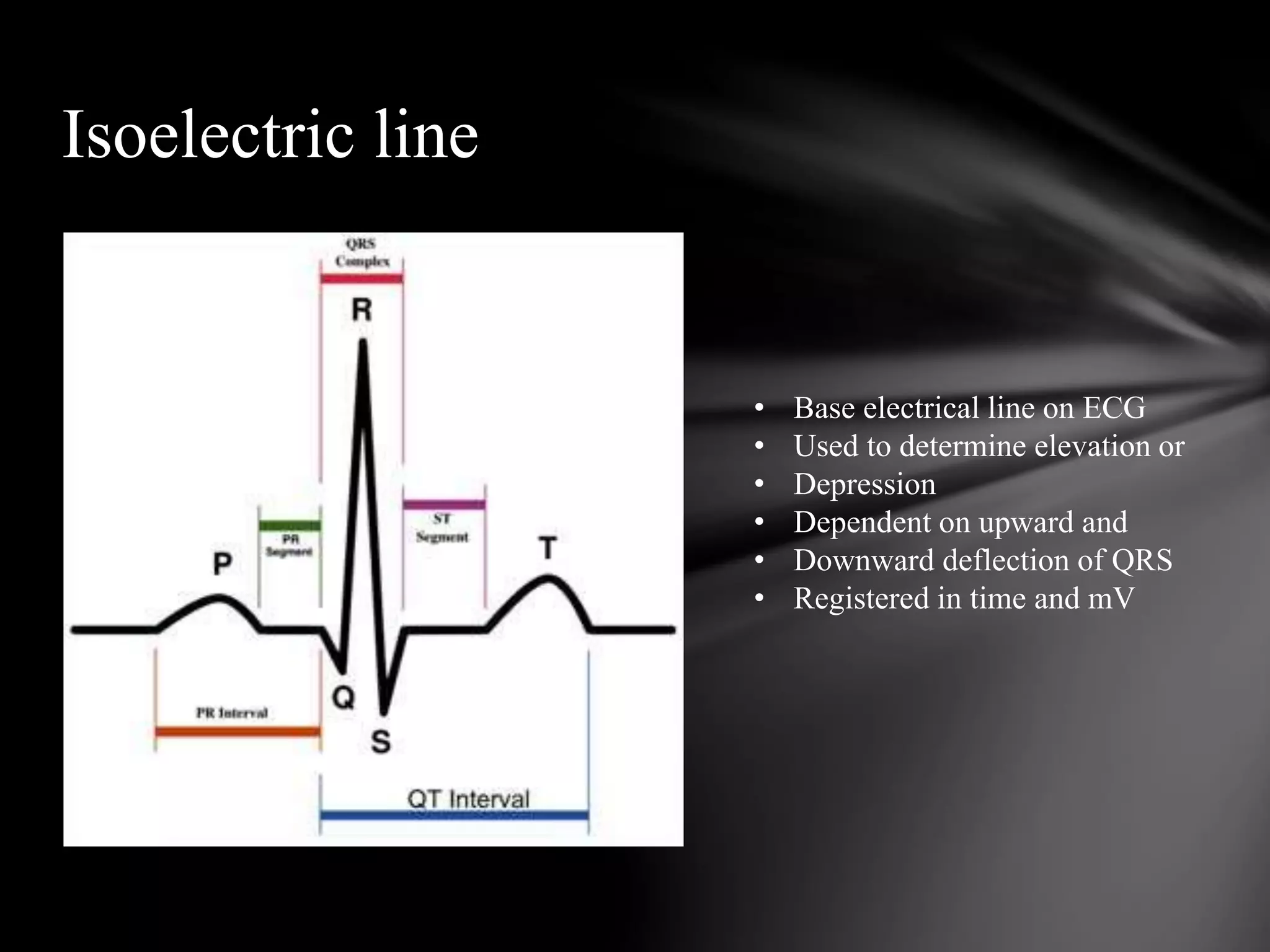 12 lead interpretation | PPTX