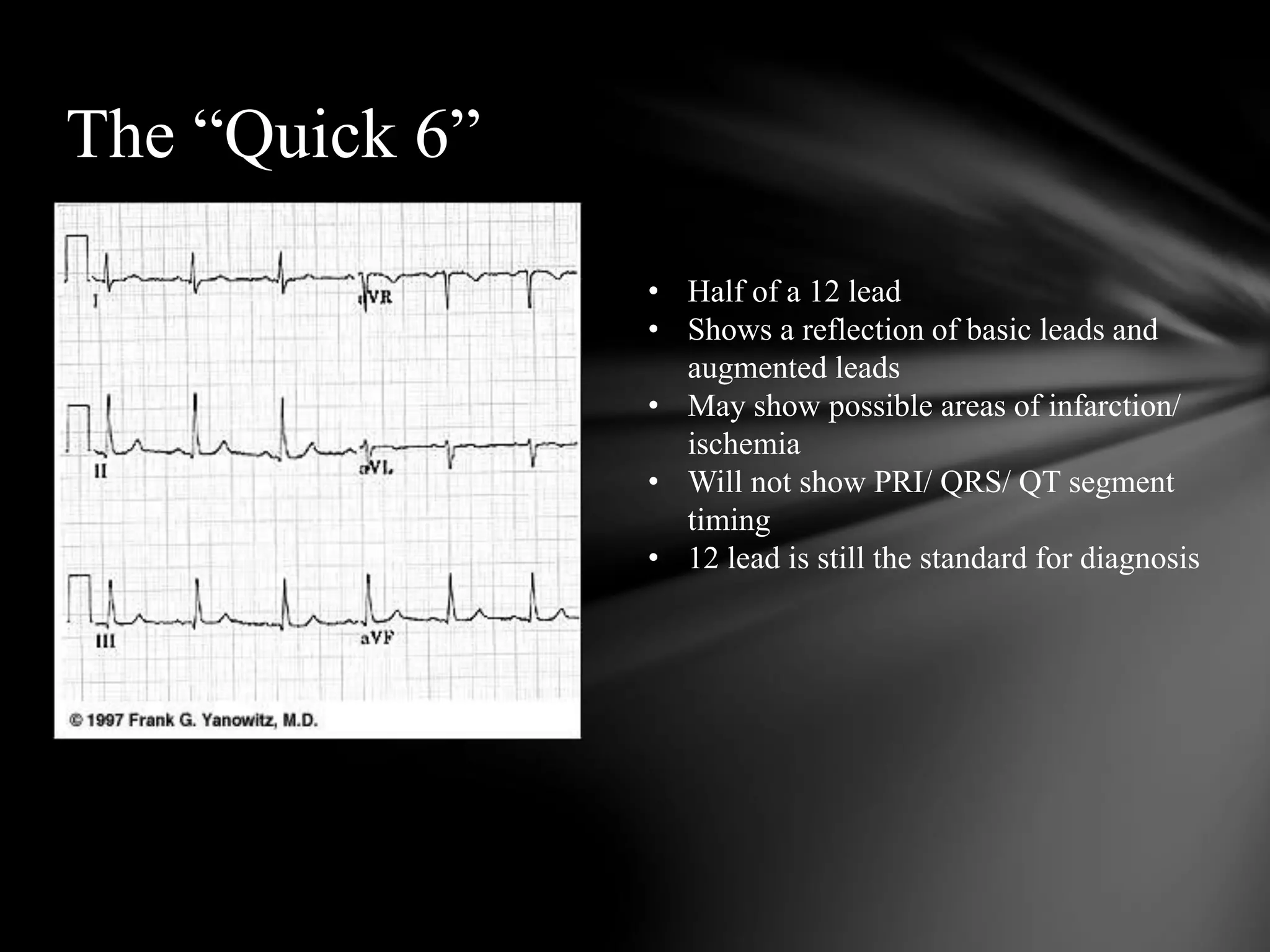 12 lead interpretation | PPTX