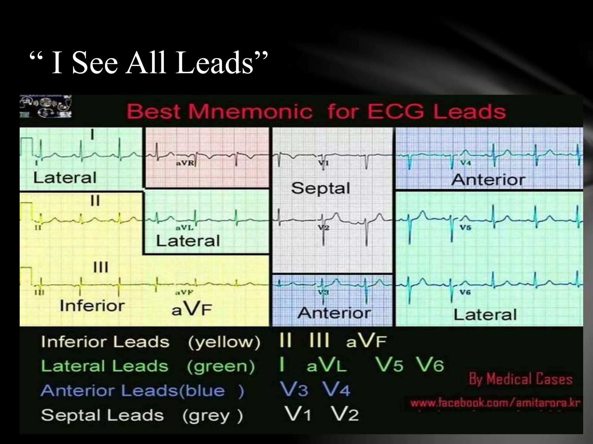 12 lead interpretation | PPTX