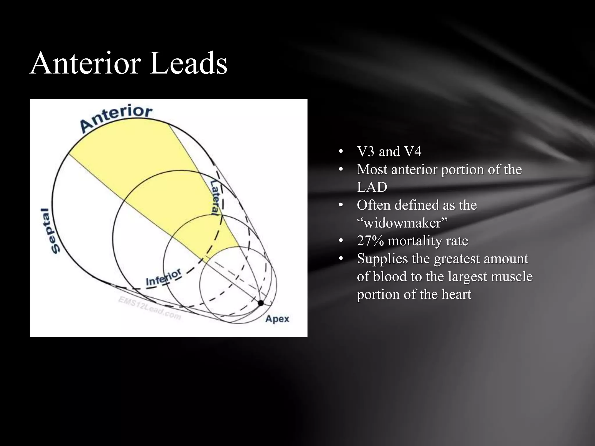 12 lead interpretation | PPTX