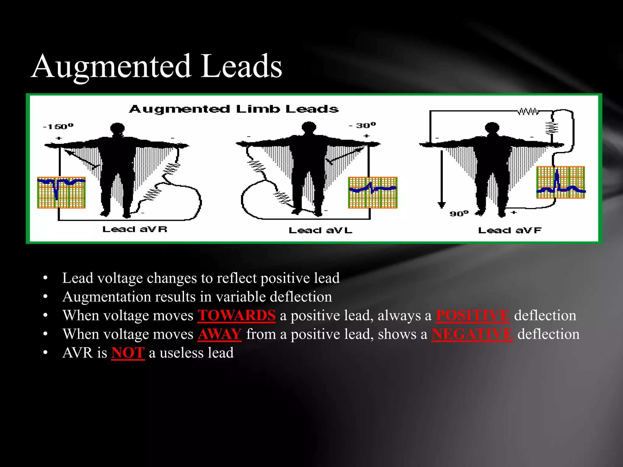12 lead interpretation | PPTX