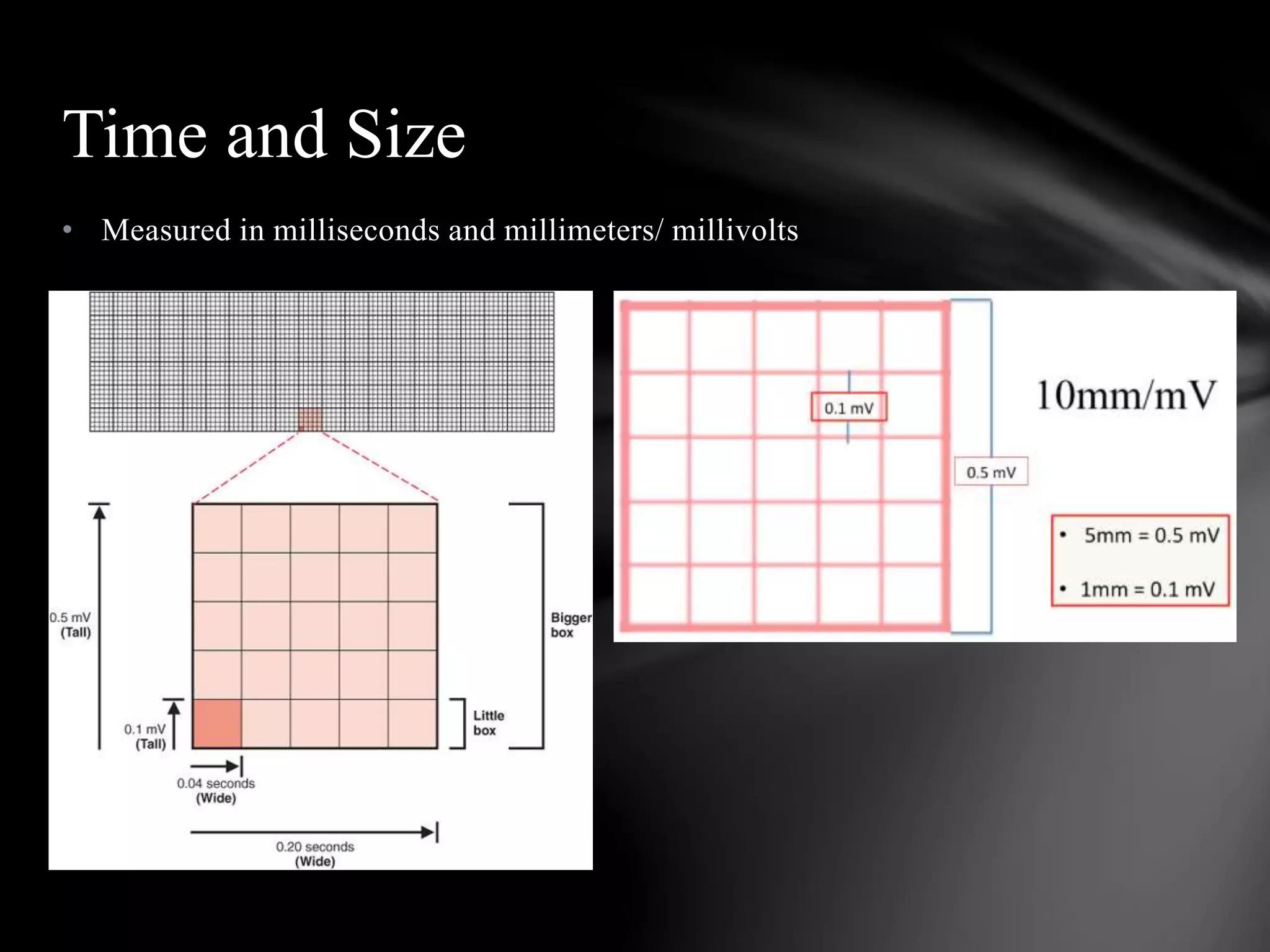 12 lead interpretation | PPTX