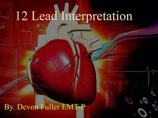 12 lead interpretation | PPTX