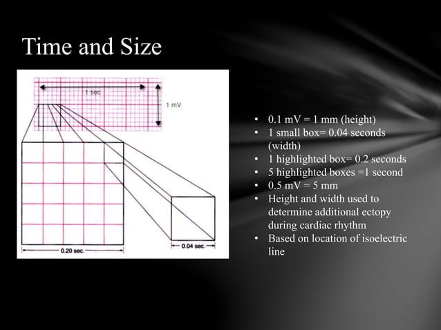 12 lead interpretation | PPTX | Heart and Cardiovascular Diseases ...