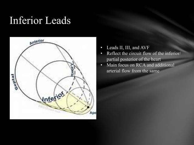 12 lead interpretation | PPTX | Heart and Cardiovascular Diseases ...