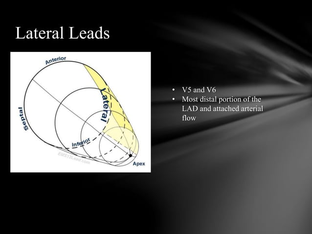 12 lead interpretation | PPTX | Heart and Cardiovascular Diseases ...