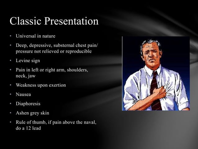 12 lead interpretation | PPTX | Heart and Cardiovascular Diseases ...