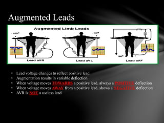 12 lead interpretation | PPTX