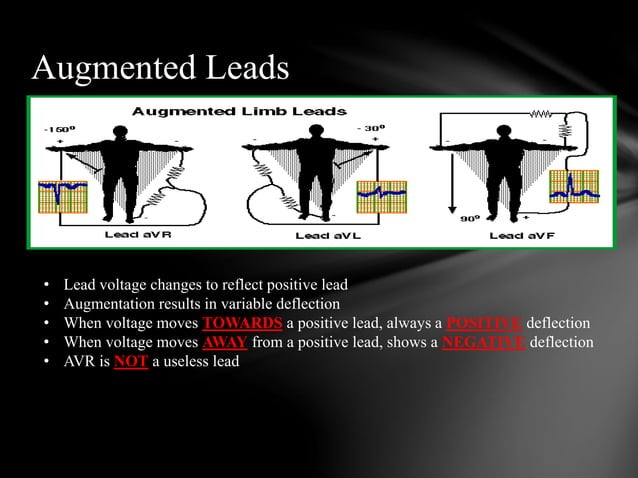 12 lead interpretation | PPTX | Heart and Cardiovascular Diseases ...