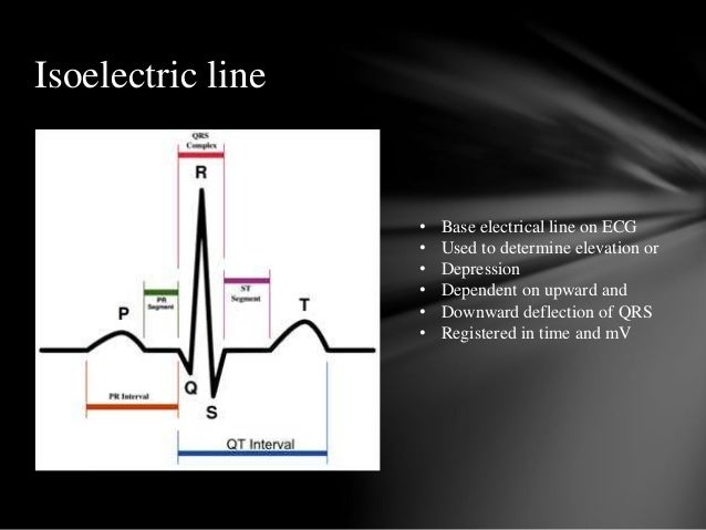 12 lead interpretation