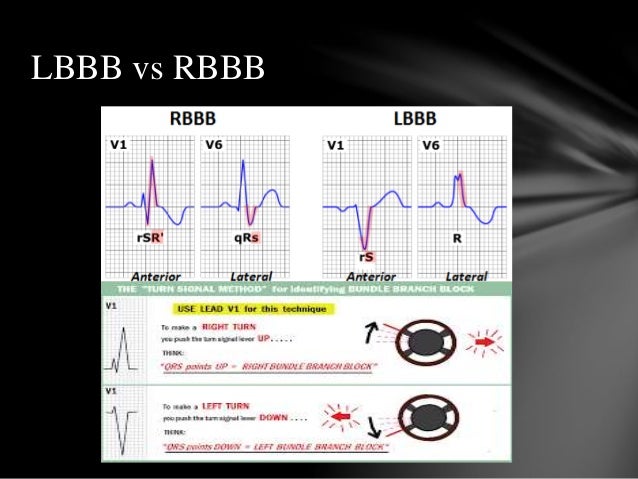 12 lead interpretation
