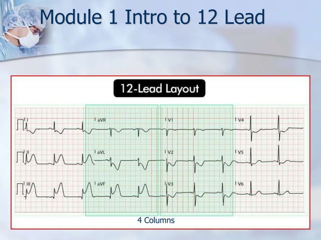 12 Leads Made Easy | PPTX