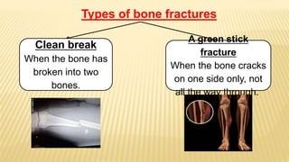 12lesson 5 body systems part1 | PPT