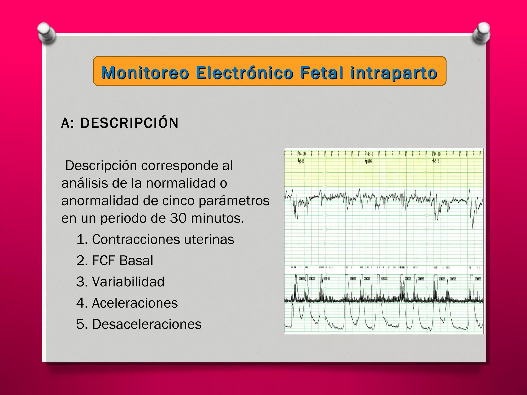 Monitoreo fetal intraparto | PPT