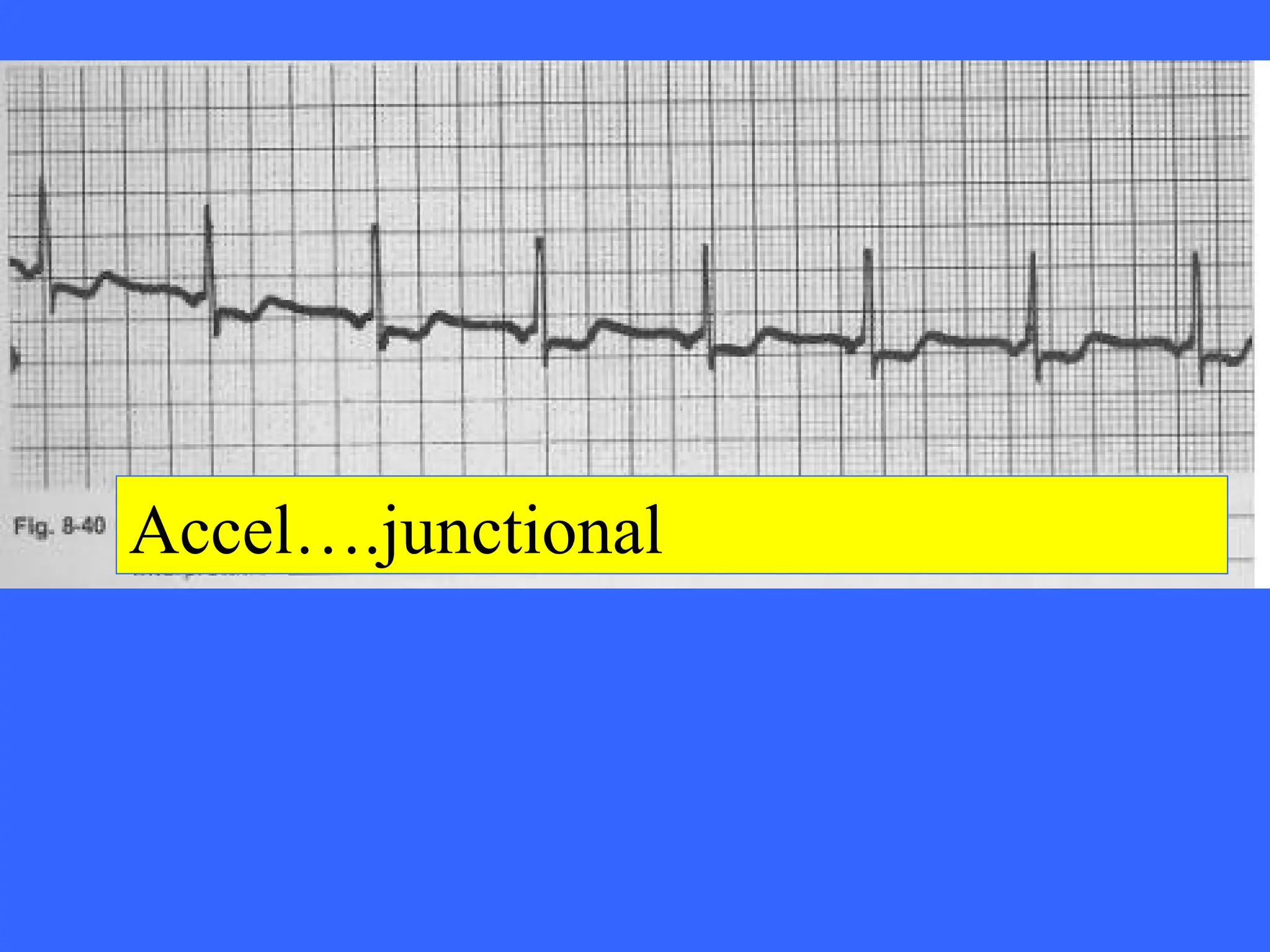 12O of ECG for learning and practicing cardiolog | PPT