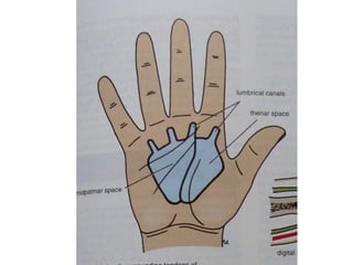 12 PALM 2 anatomy of palm in upper limb.pptx