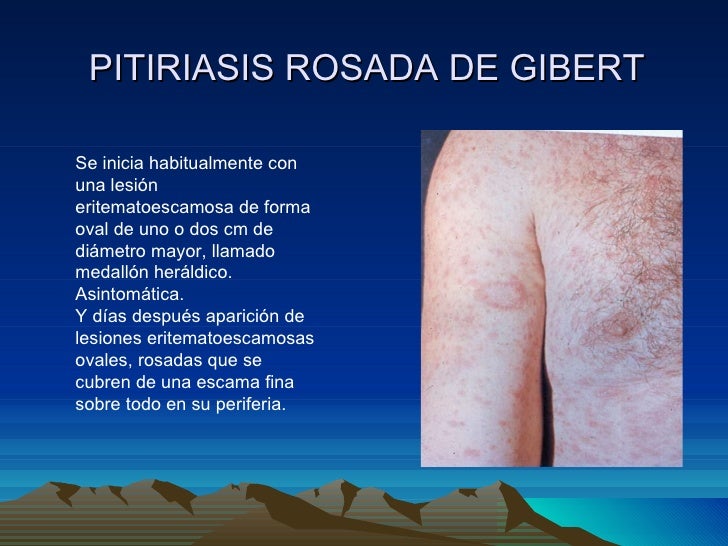 12 psoriasis, liquen, pit.rosada,fotodermatosis