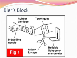 12 Regional Anaesthesia.ppt