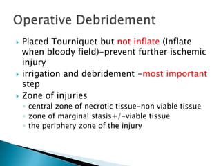 12 rw principles of mangled extremity management | PPTX