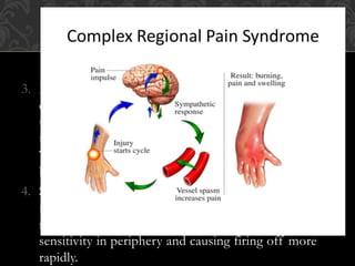 CRPS (Complex regional pain syndrome) | PPTX