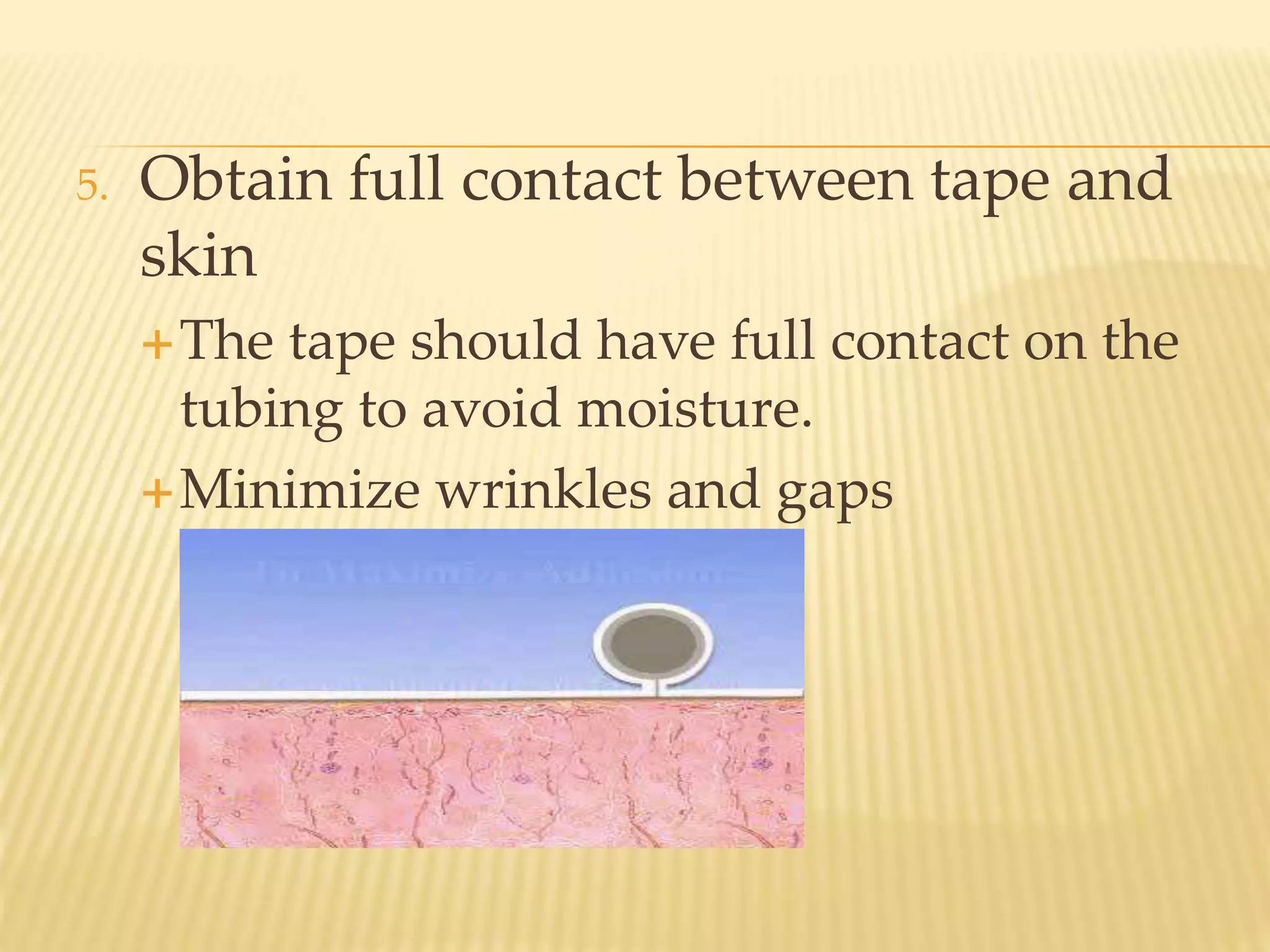 12 taping and techniques | PPTX