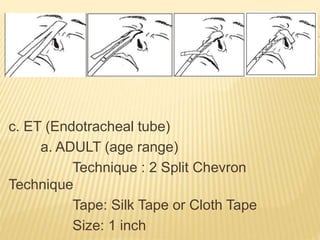 12 taping and techniques | PPTX