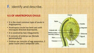 12th Biology Practical Spotting Q.4.pptx
