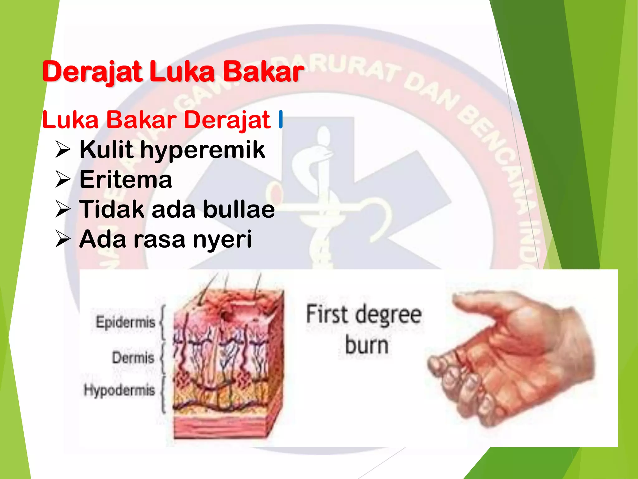 12 Thermal Trauma / Luka Bakar | PDF