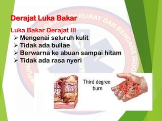 12 Thermal Trauma / Luka Bakar | PDF