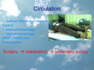 12 trauma – initial assessement and management | PPT