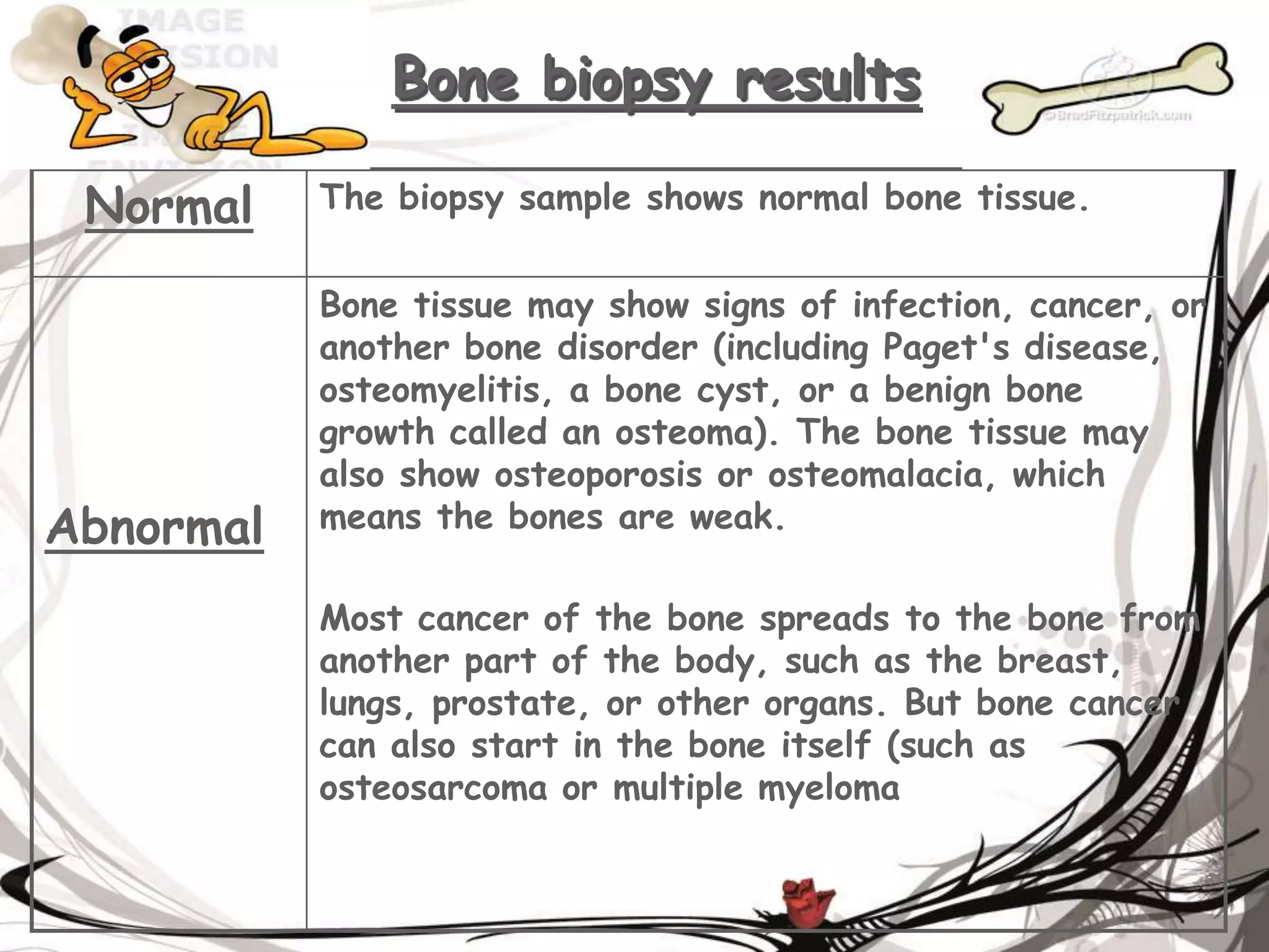 13 04-2015 bone biopsy and its decalcification stmu | PPT