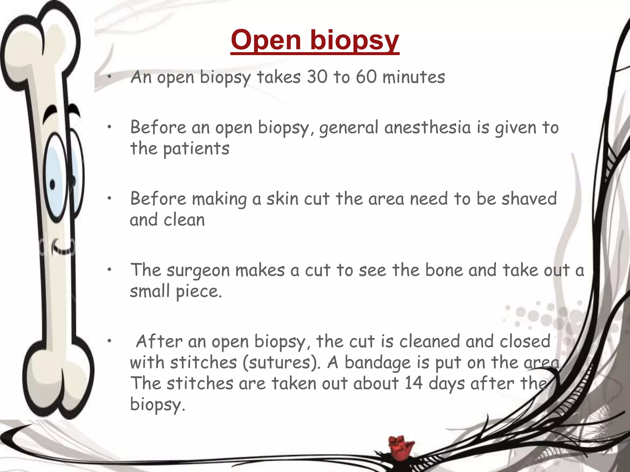 13 04-2015 bone biopsy and its decalcification stmu | PPT
