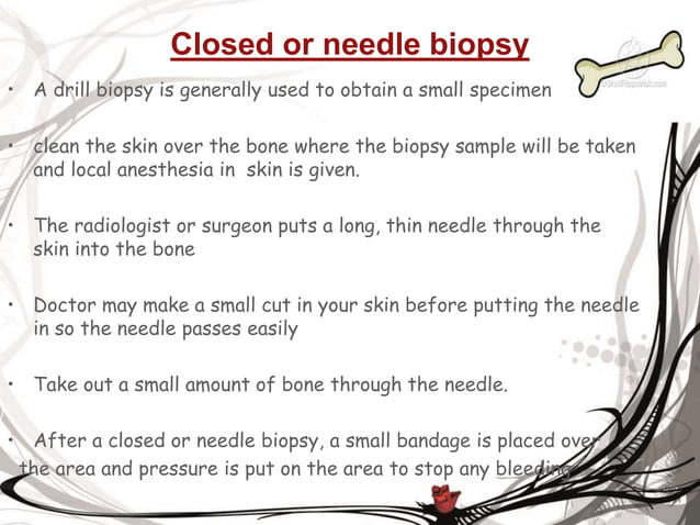 13 04-2015 bone biopsy and its decalcification stmu | PPT