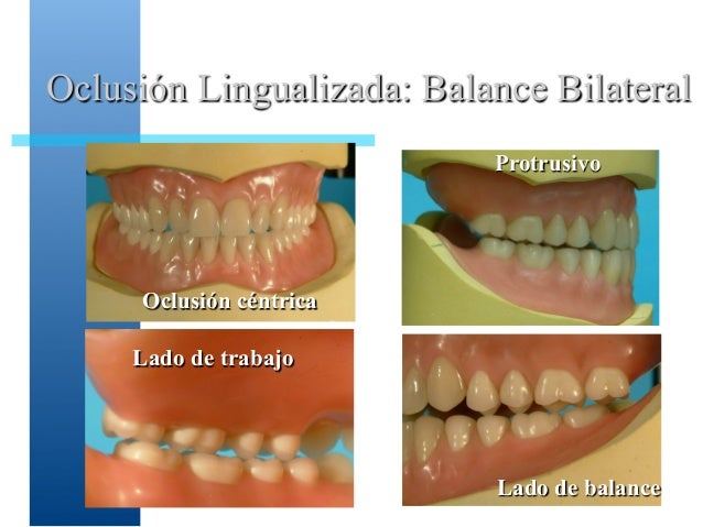 13. la quinta de hanau (hanau quint)