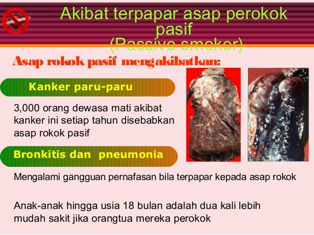 Rokok itu berbahaya